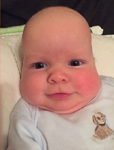 Mum shocked to find out reason for baby’s ‘oddly shaped’ head